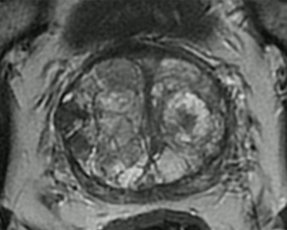MRT der Prostata – Radiologie im Centrum